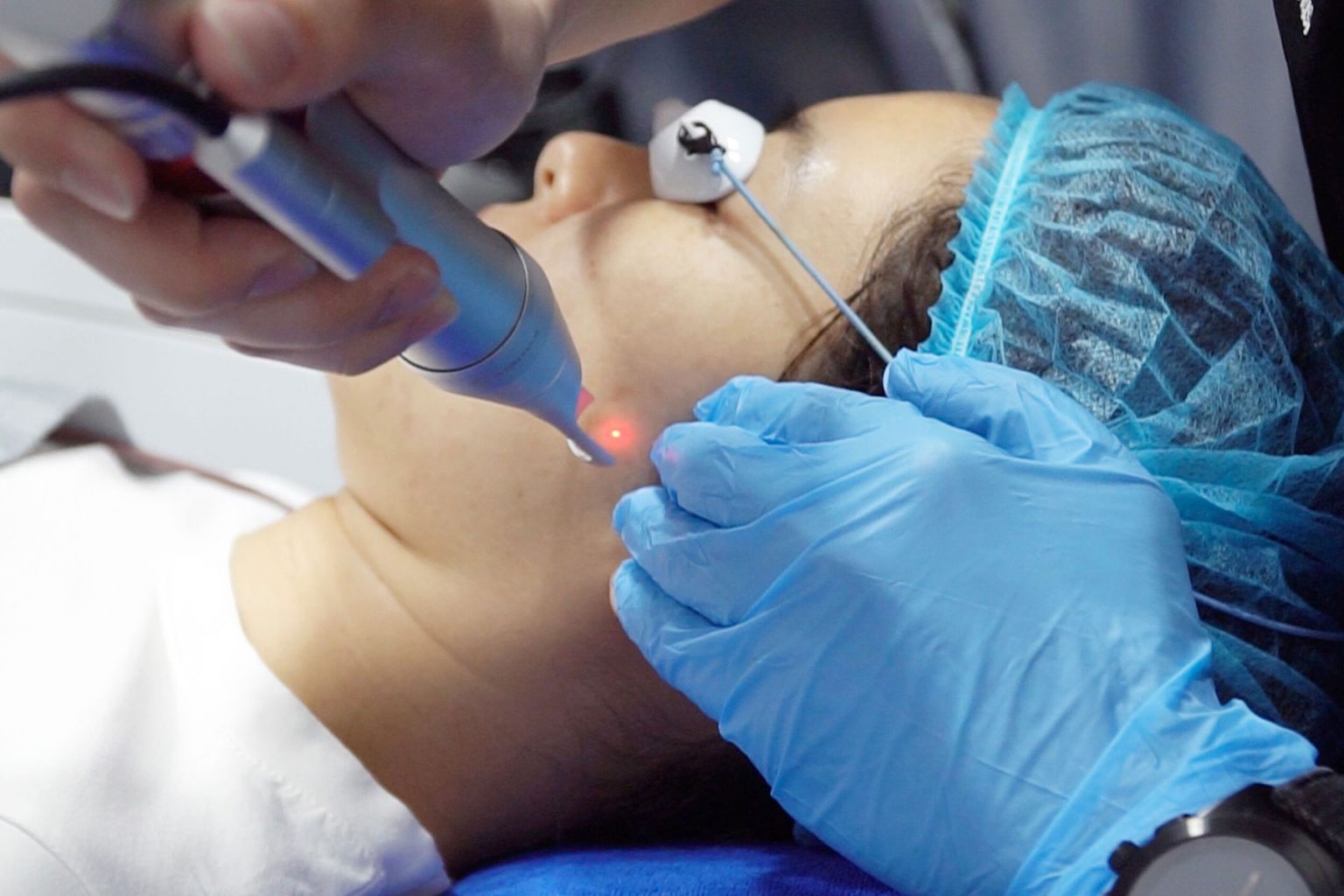 Review What One Doc s 4 step Pico Laser Treatment Can Do For Your Skin
